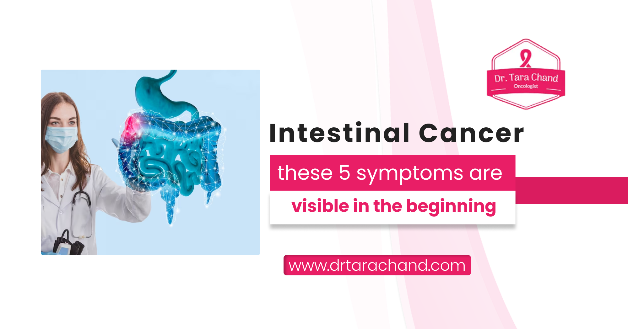 Intestinal Cancer these 5 symptoms are visible in the beginning