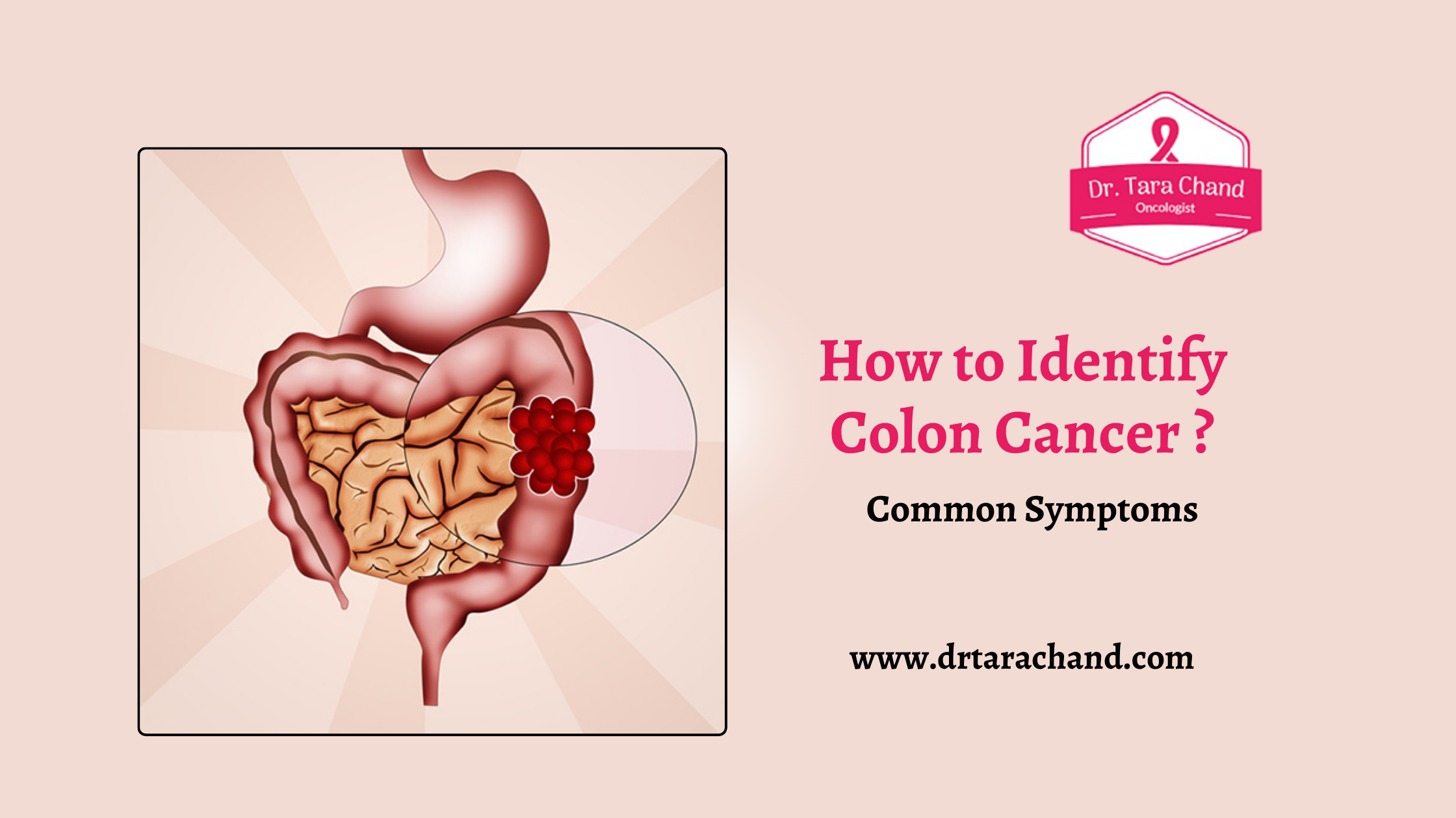 How to Identify Colon Cancer - Symptoms | Dr. Tarachand Gupta